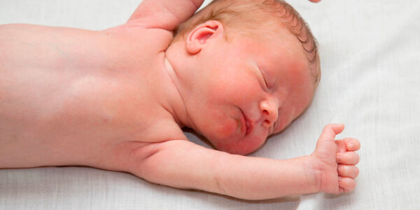 REFLEJO DE MORO - Estrella Guía